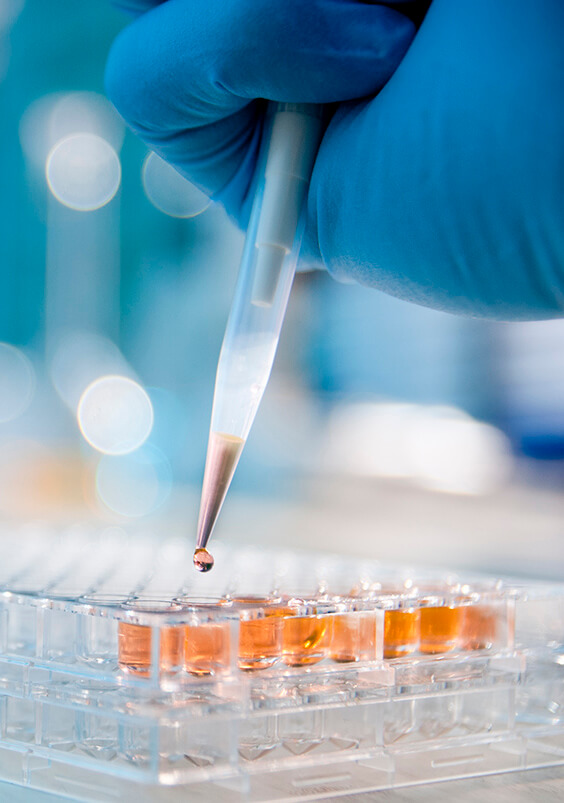 serologie casablanca - LaboPlus - Laboratoire de biologie médicale